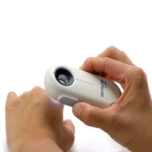 DermLite DL100 Dermatology Dermascope | Medical Equipment