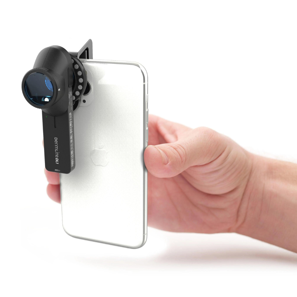 DermLite DL1 Dermatoscope | DermLite Dermatoscopes