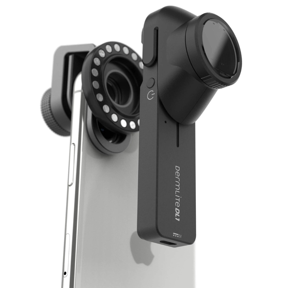 DermLite DL1 Dermatoscope | DermLite Dermatoscopes